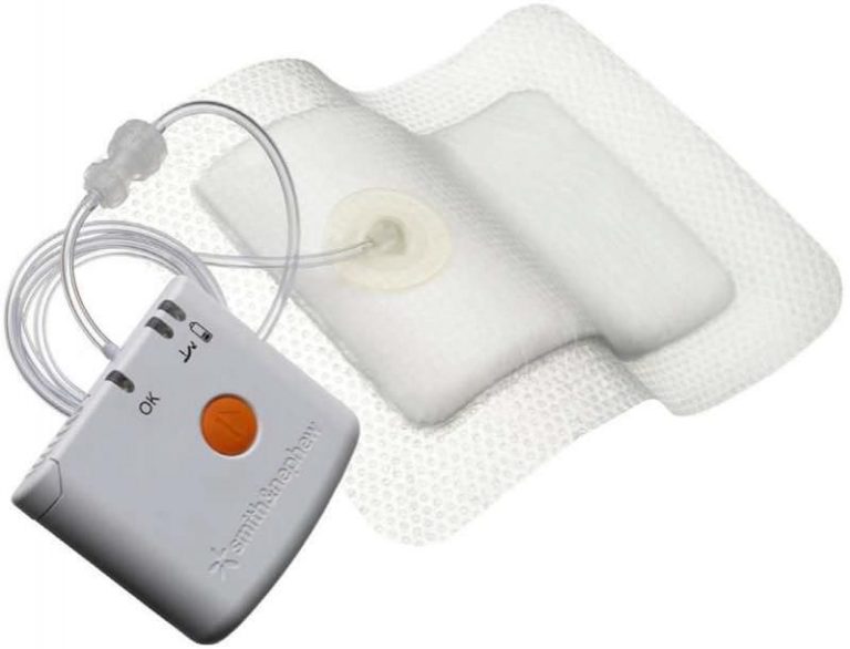 Post-operative use of PICO™ Single use Negative Pressure Wound Therapy ...