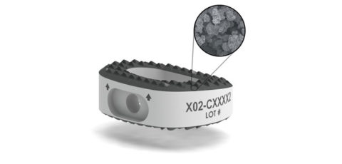 Tyber Medical Launches TyPEEK® Lateral Implant System – Oasis Surgical