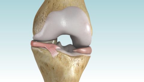 Arlington Orthopedic Associates, P.A. Performs First Meniscus ...
