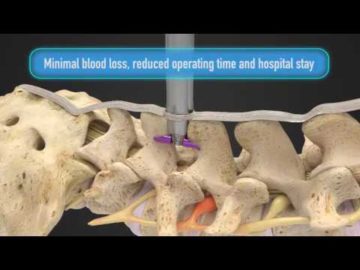 Andrew Cottingham, MD First Pain Management Doctor to Perform the ...