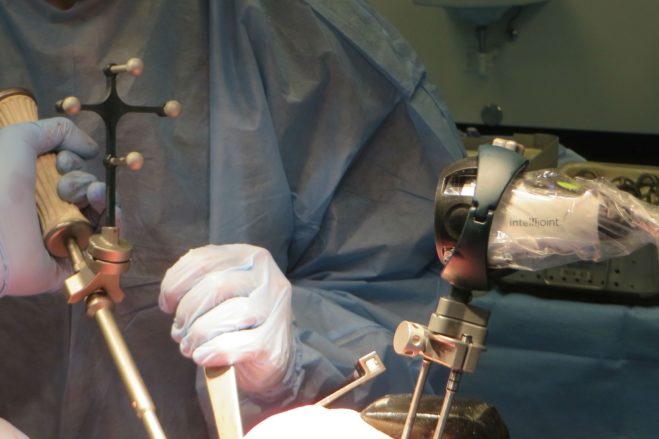 Intellijoint Surgical® Completes One Thousand Total Hip Replacement ...