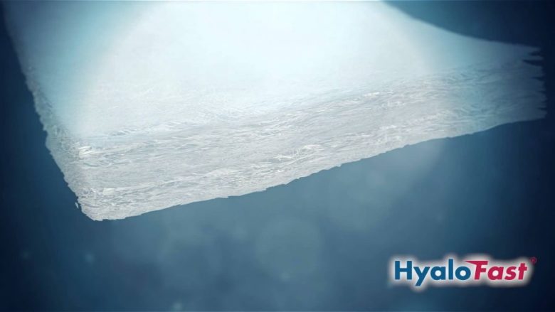 Anika Announces Plans to Showcase HYALOFAST Hyaluronic Acid-Based ...