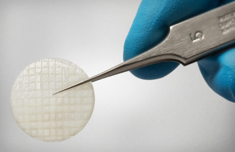 AlloSource and Stryker Launch ProChondrix CR Cryopreserved ...