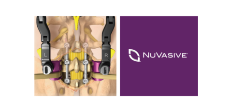 NuVasive Portfolio Introduces Low-Profile Modular Implants For ...
