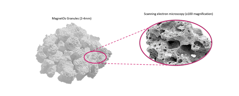 Kuros Reports Publication of MagnetOs Data Demonstrating Equivalence to ...